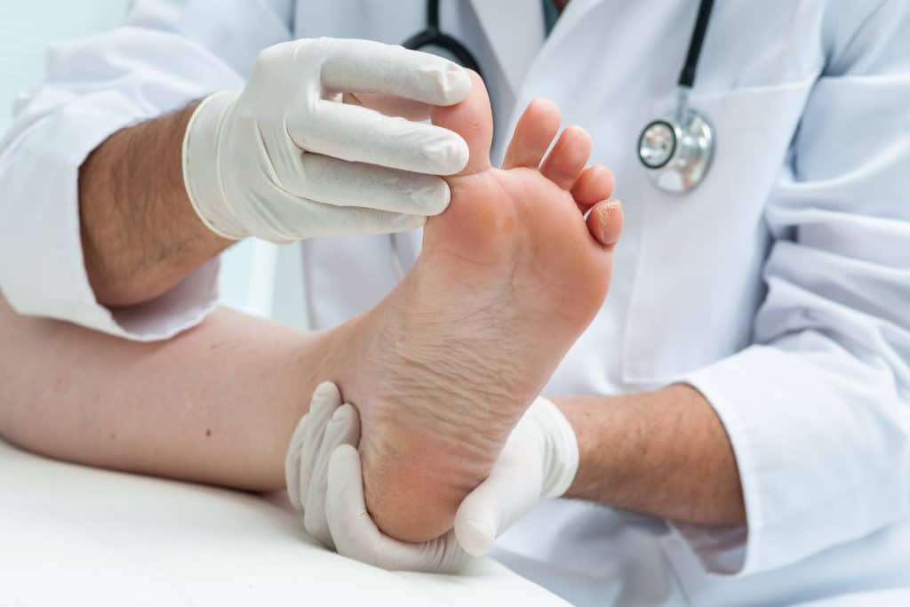 Hallux valgus : reprise de la marche